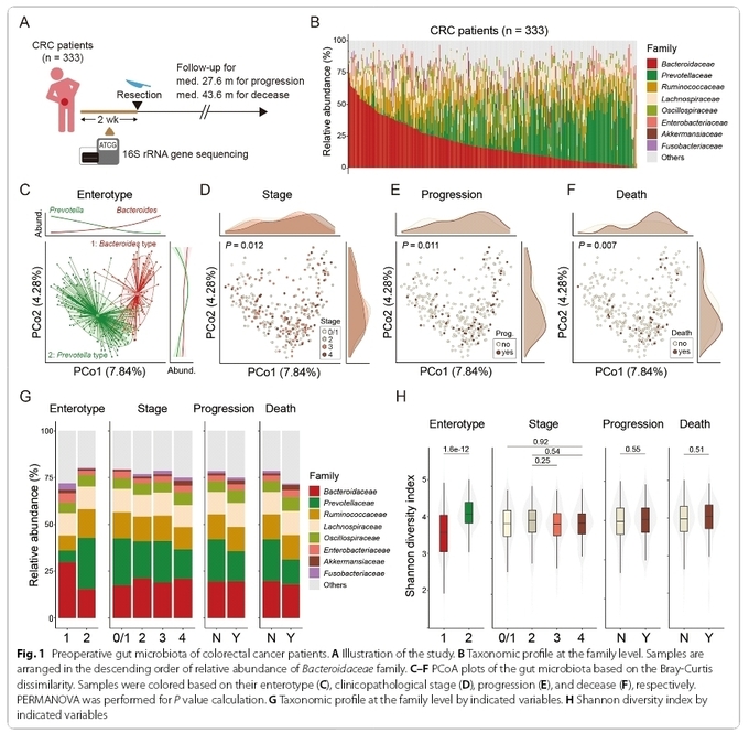 대변에 '이것' 많이 존재 할수록 대장암 예후 긍정적